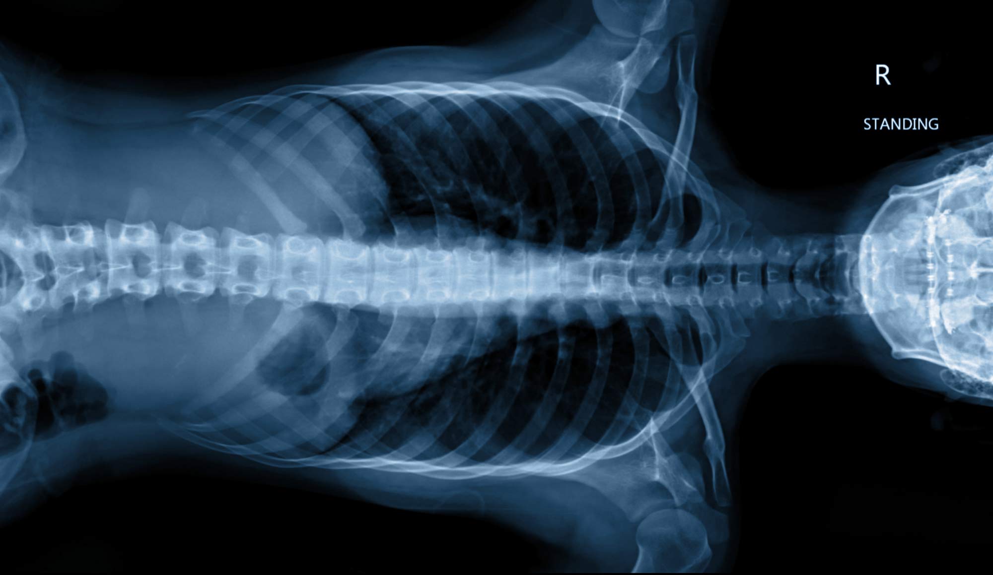 Chest Radiology & Lung Cancer Screening in Fort Myers | Florida ...