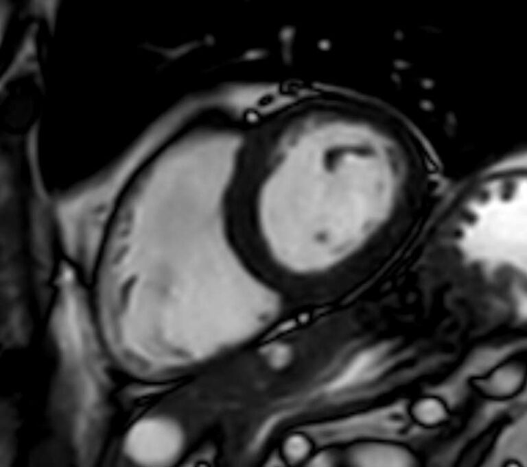 Advanced Cardiac Imaging at Florida Radiology Consultants in Fort Myers FL