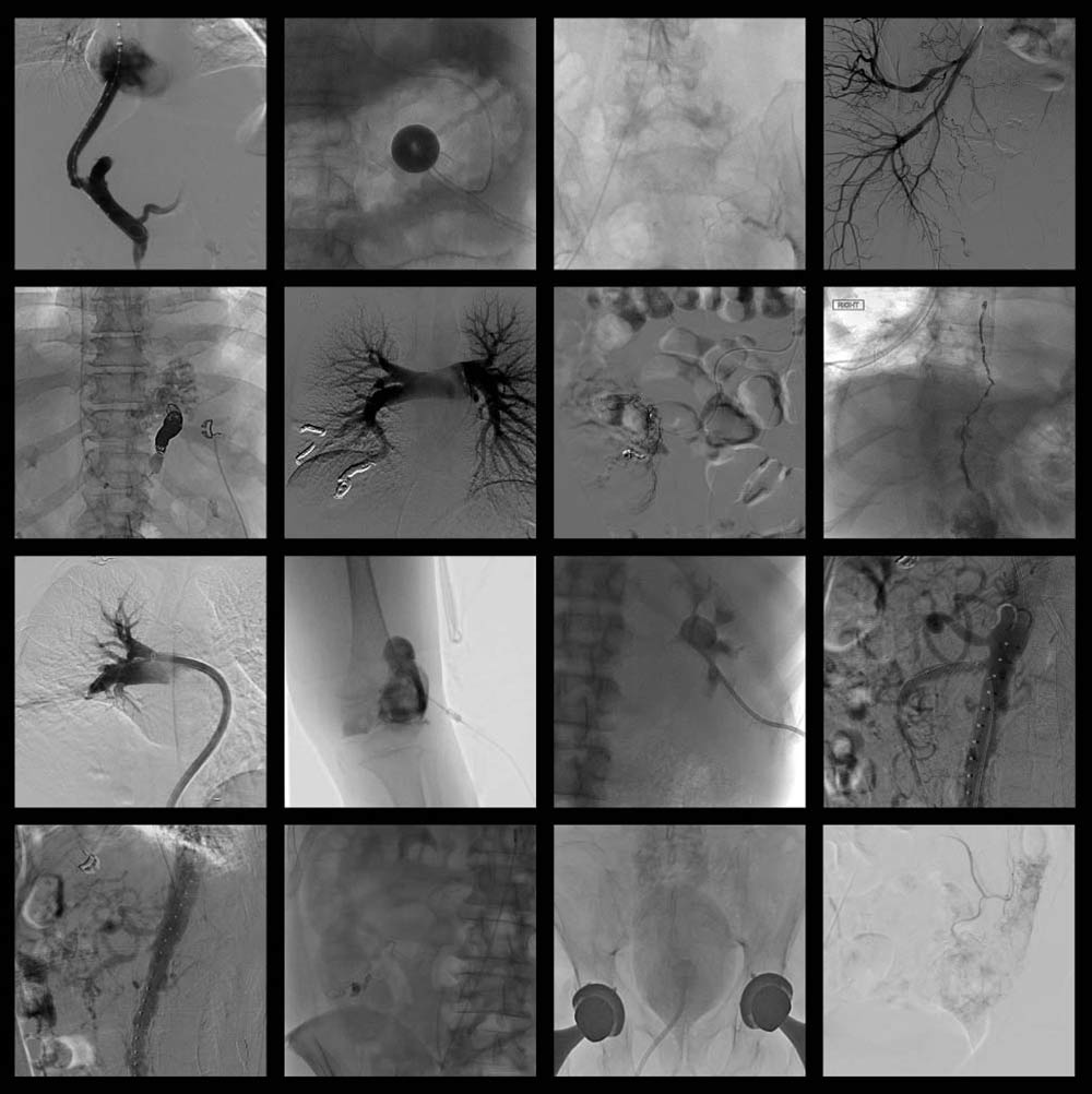 Interventional Radiology Procedures at Florida Radiology Consultants in ...